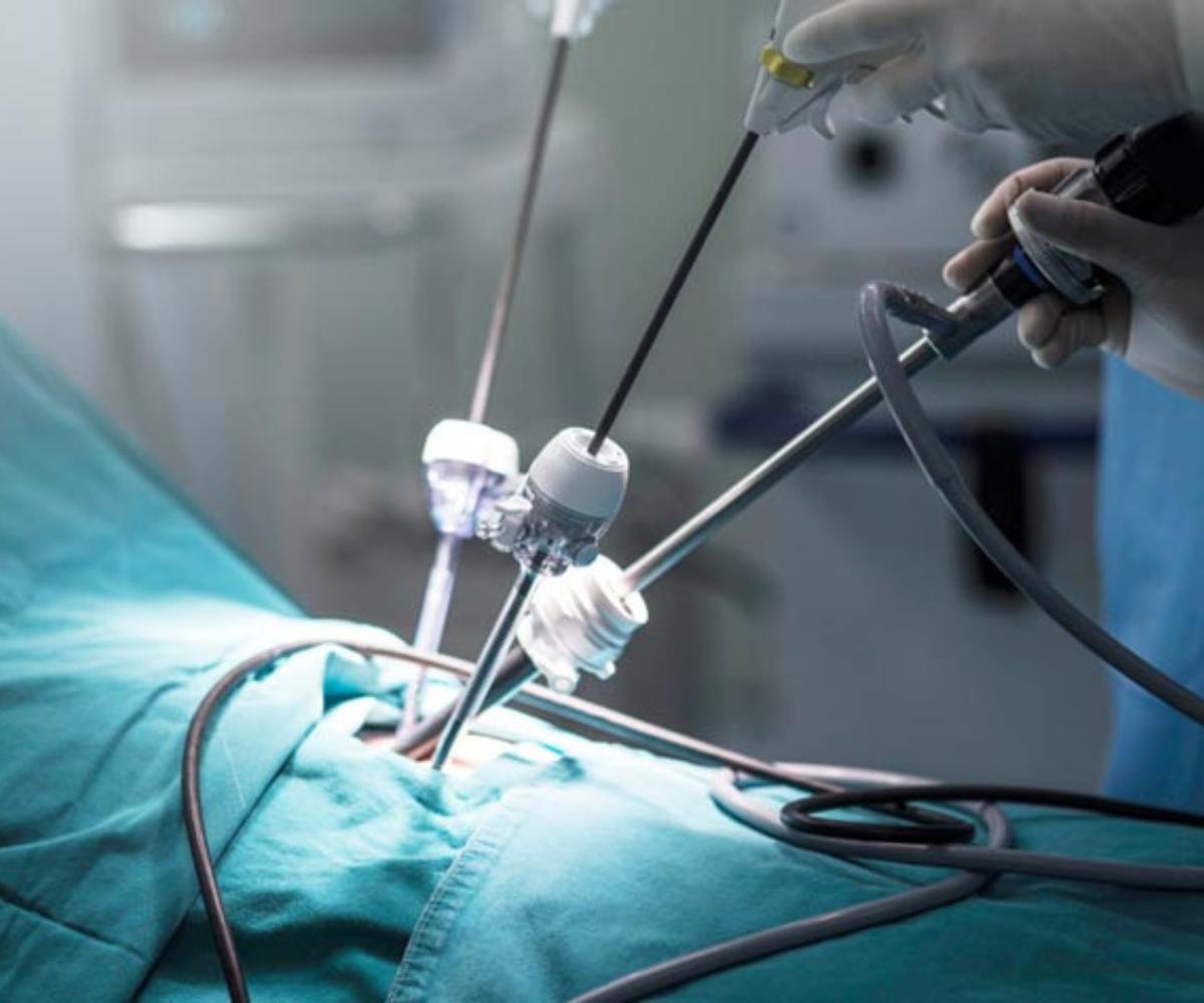 Laparoscopic Surgery for Fertility in Mohali, Chandigarh, Amritsar